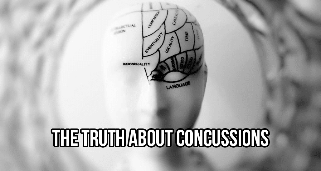 The Truth About Concussions Orthopedic Associates